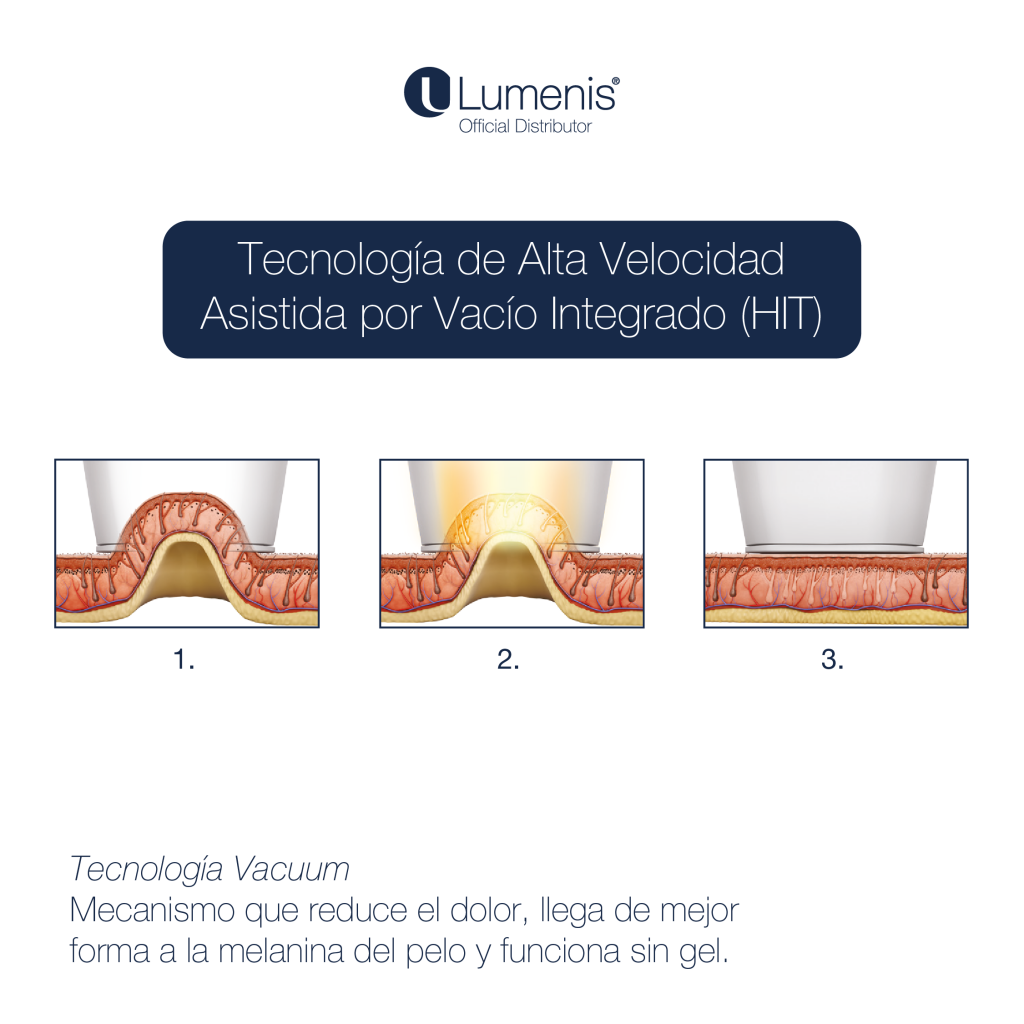 LightSheer QUATTRO | IMV MED | Ingeniería Médica de Vanguardia